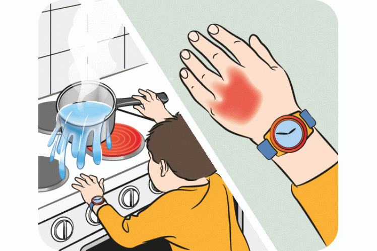 PENJAGAAN LUKA MELECUR