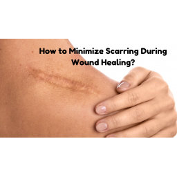 How to Minimize Scarring During Wound Healing: Tips and Techniques