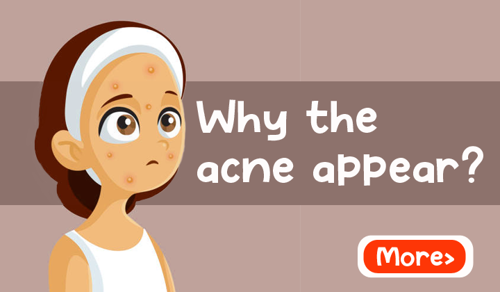 Acne: Understanding the Common Skin Condition